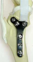 TPLO Plate Locking 3.5 Right [TPLO35LPCR]
